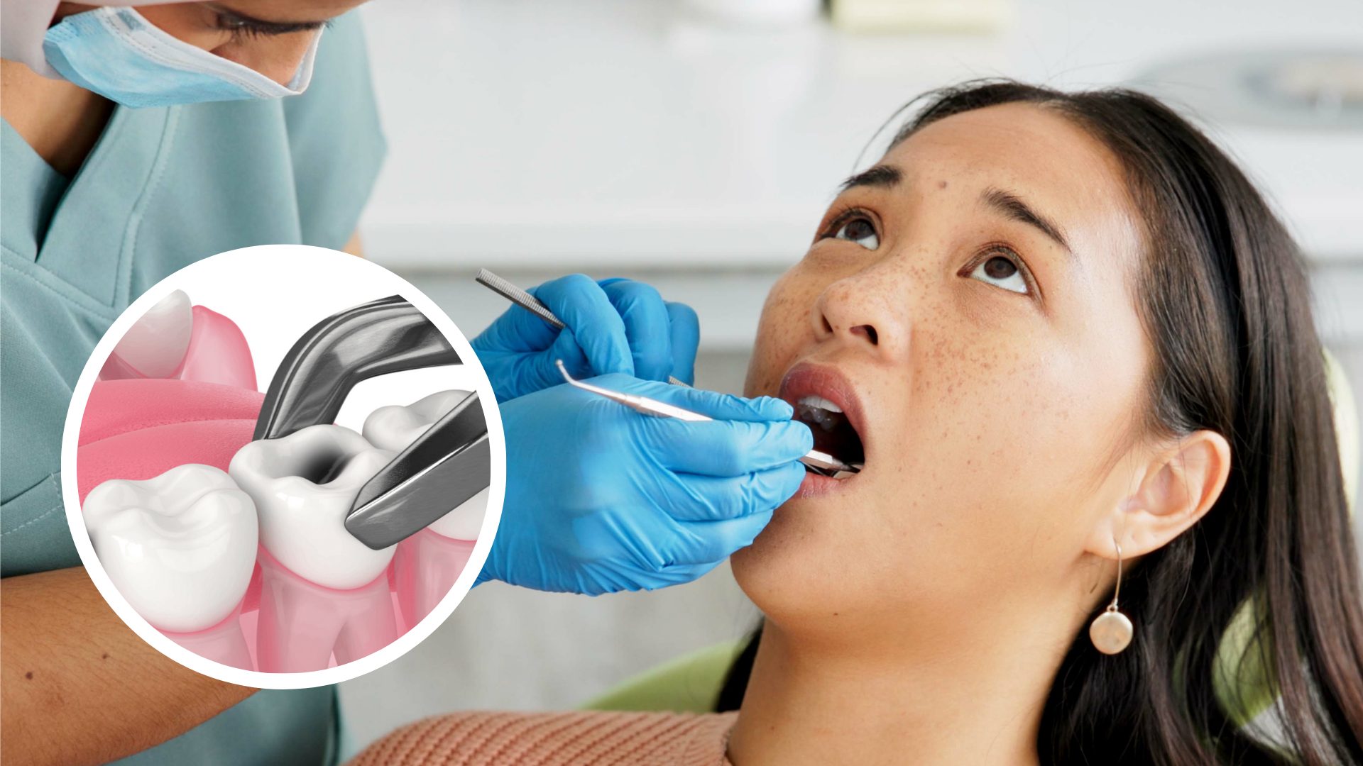Tooth Extraction: What You Need to Know Before and After